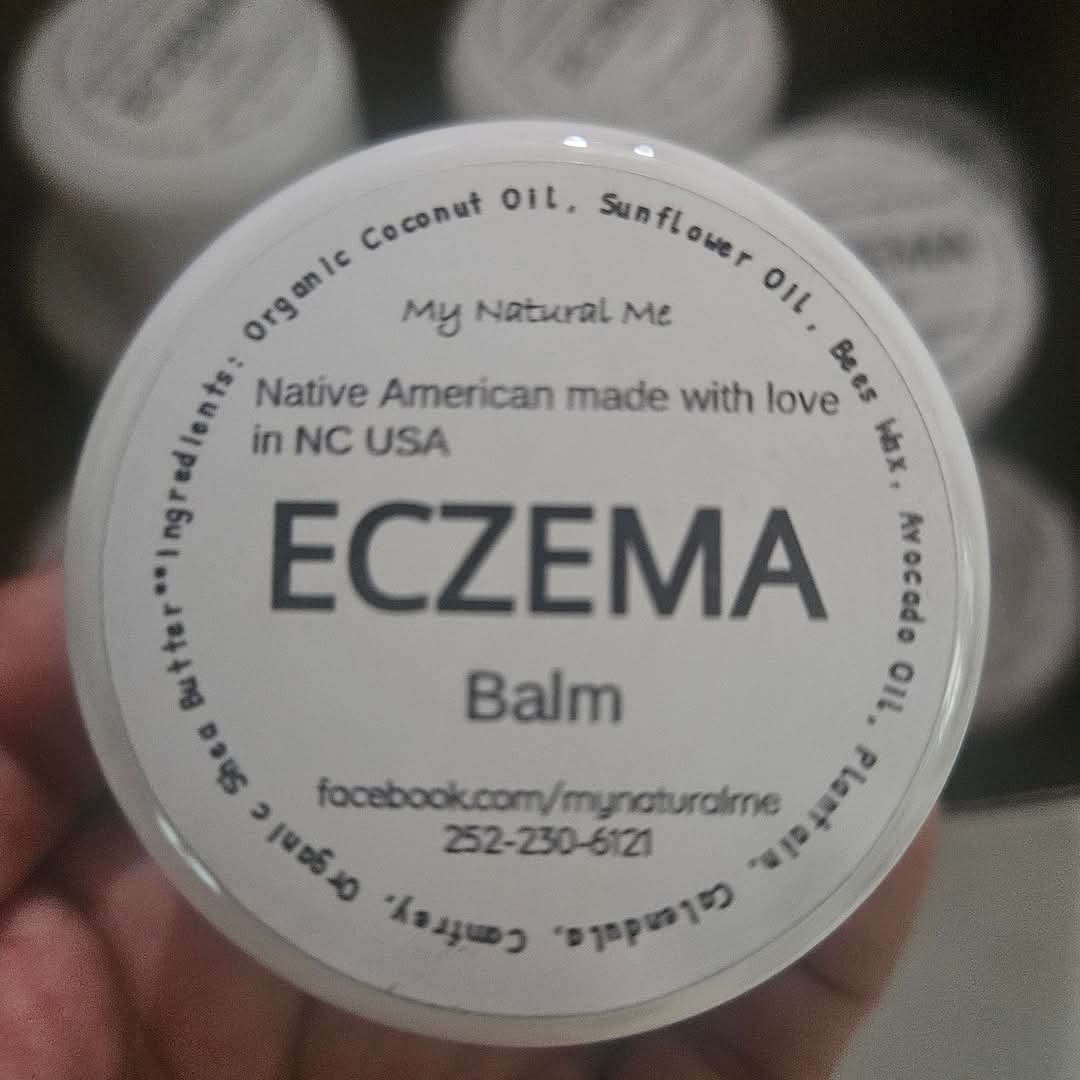 Eczema Balm – First Nations Trading